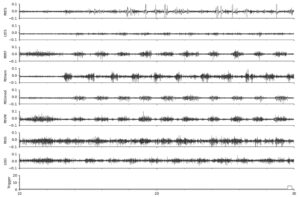 【2025年版】PythonによるDelsysの筋電図のCSVデータを可視化：リハビリ評価、コピペ可能 - YOFUKASI LAB